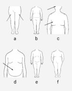 Men's Body Shape Quiz