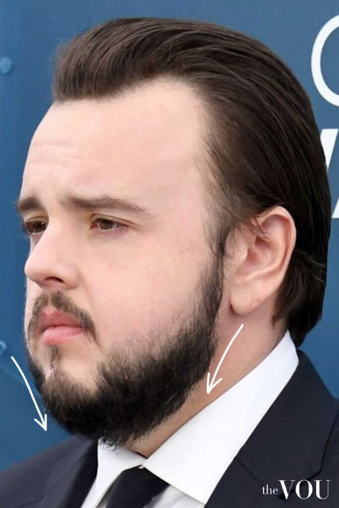 Most Recommended Beard Styles for Round Face Shape Men | The VOU